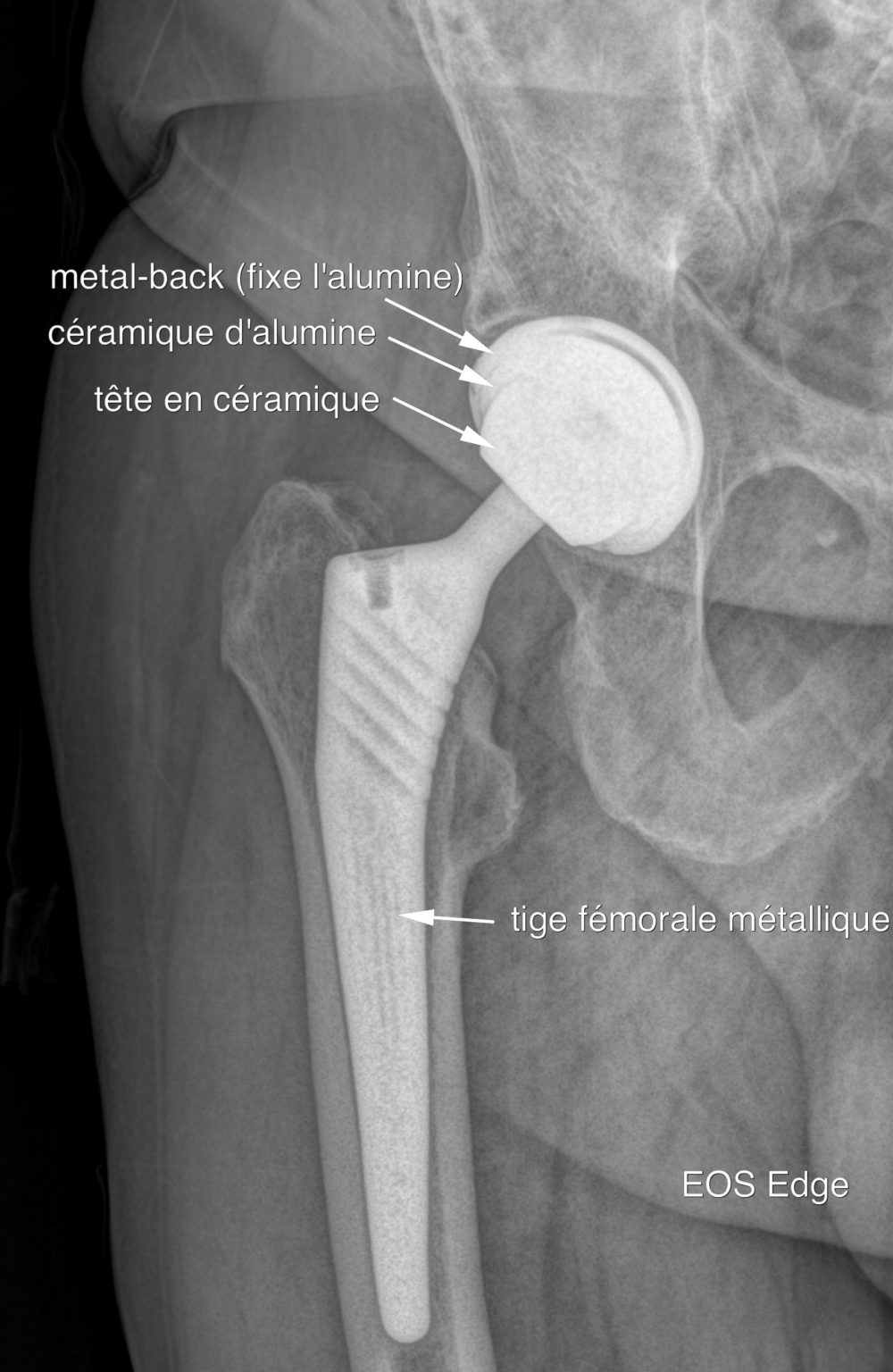 Un nouvel EOS à l'IRP