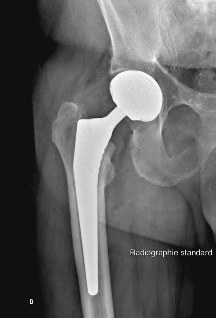 Un nouvel EOS à l'IRP